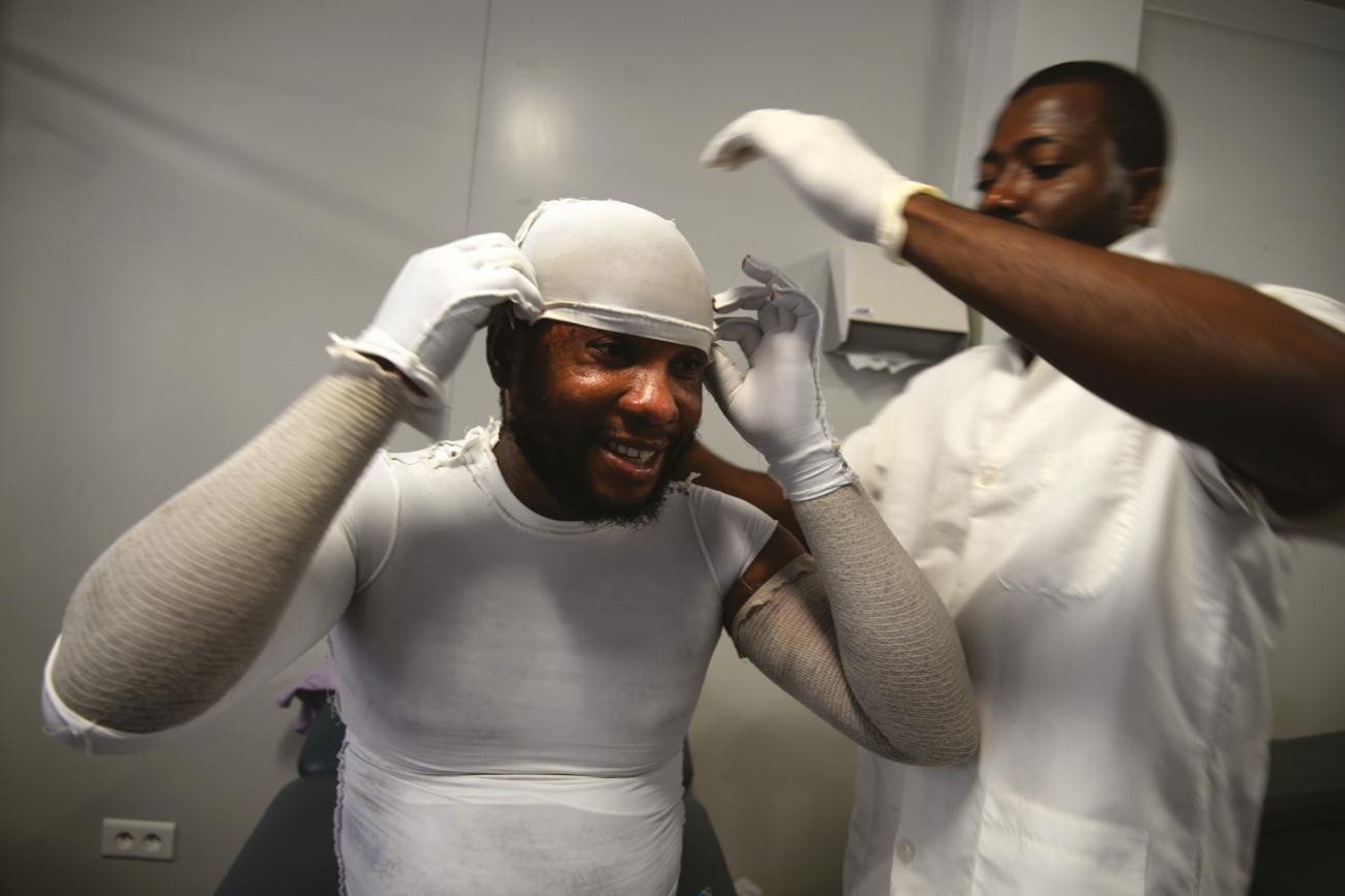 Grands brûlés : histoires à vif | Médecins sans frontières