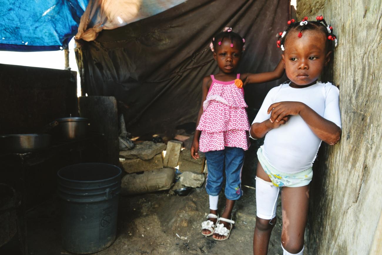 Grands brûlés : histoires à vif | Médecins sans frontières