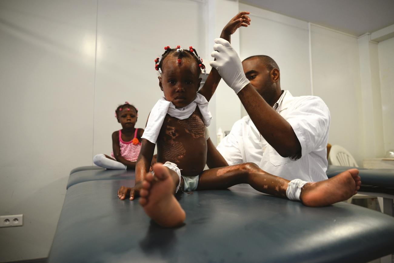 Grands brûlés : histoires à vif | Médecins sans frontières